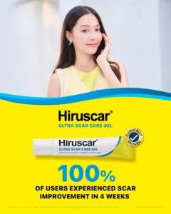 Hiruscar Gel for Scar Treatment | Hiruscar Singapore